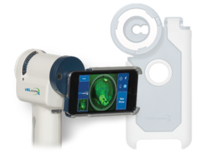 Oral Cancer Screening With Velscope | All Practice Solutions