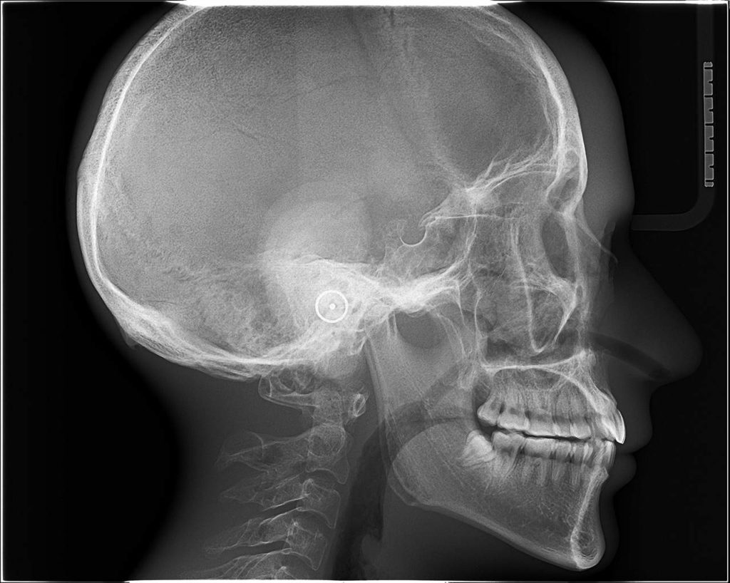 Owandy Radiology | Owandy Cone Beam - All Practice Solution