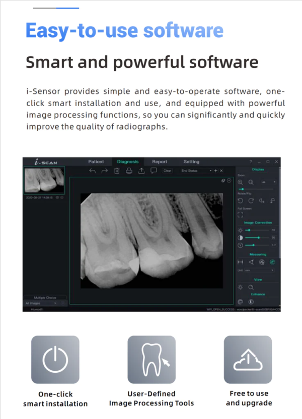 Woodpecker DBA I Sensor - Digital X-Ray with Free Software