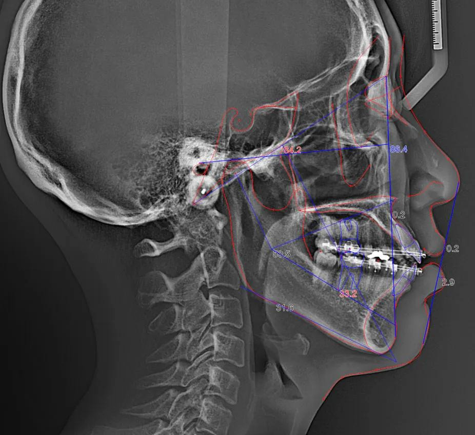 HDX Cbct Machine | Dentri Max - All Practice Solutions