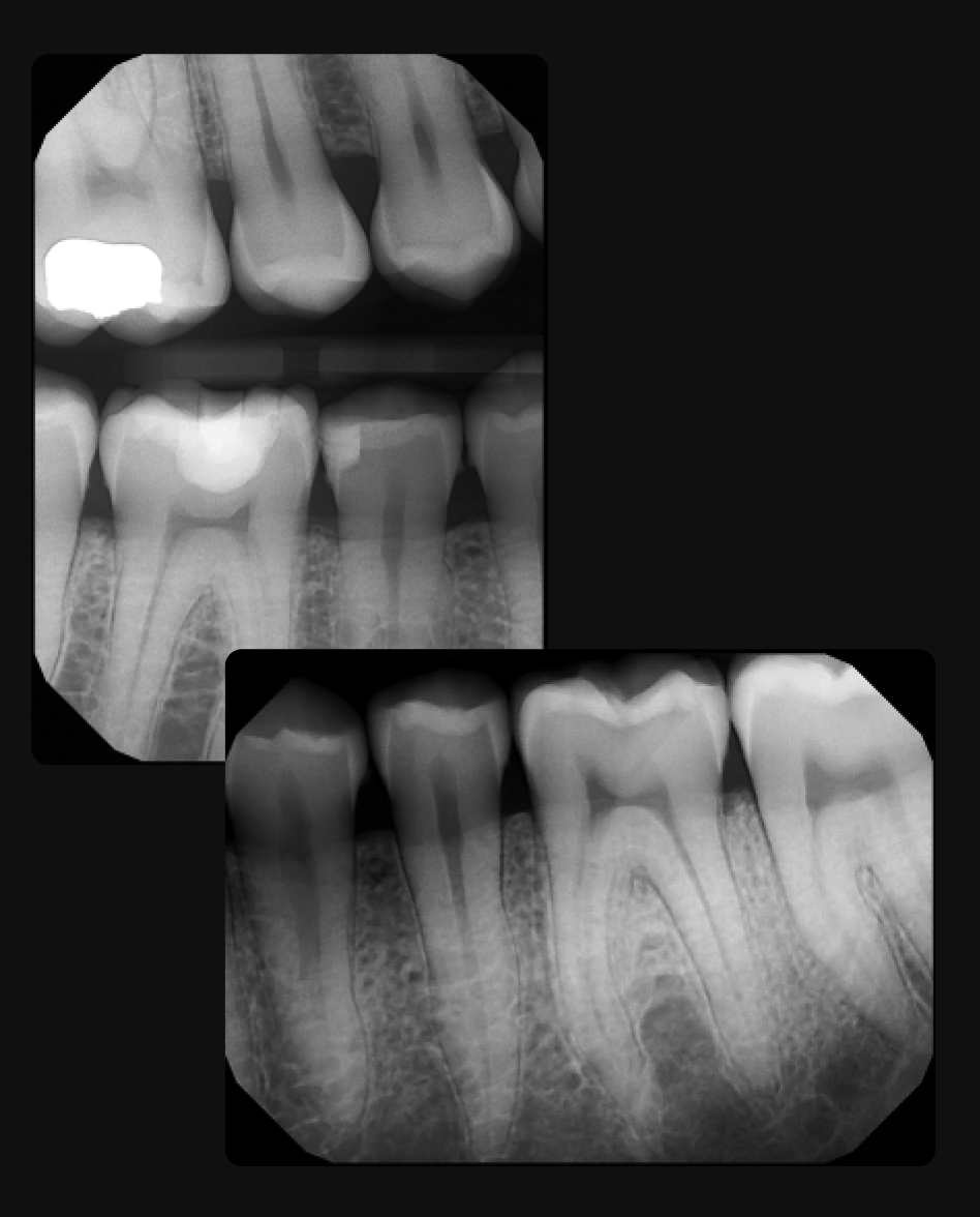 Clio Prime Elite Digital X-Ray Sensor - All Practice Solutions